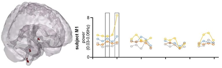 A glimpse into brainstem functional oscillations across individual ...